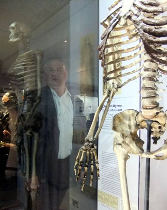 Giant Human Skeleton Museum Pickled Toads And Dodo Bones — Ernest